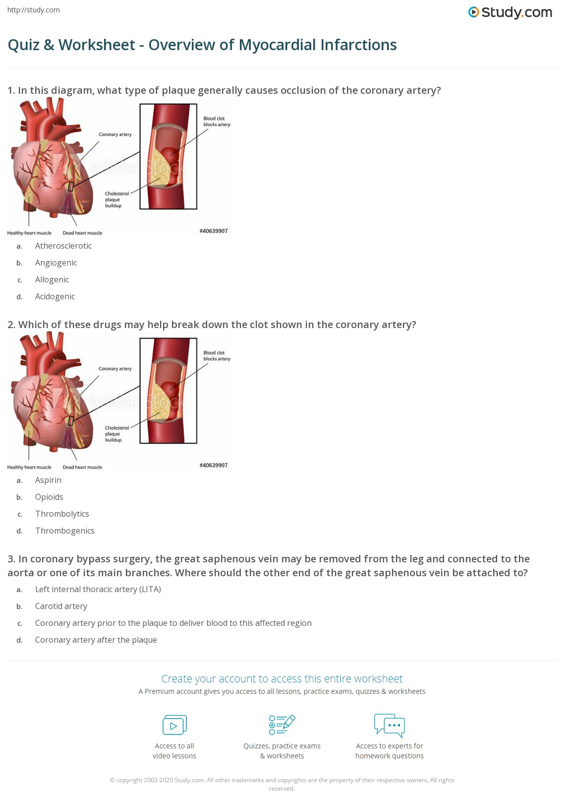Quiz & Worksheet - Overview of Myocardial Infarctions | Study.com