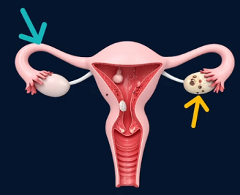 Adnexa Uteri | Definition, Structure & Functions - Lesson | Study.com