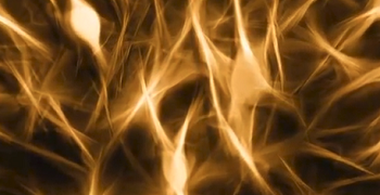 Reticular Activating System | Definition & Function - Lesson | Study.com