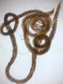 Helminths | Definition, Transmission & Examples - Lesson | Study.com