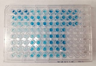 Identifying Mycobacteria, Viruses & Other Microorganisms in Macroscopic ...