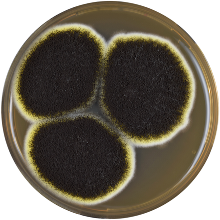 Radiotrophic Fungus | Definition & Examples - Lesson | Study.com