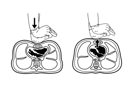Cardiopulmonary Resuscitation | CPR Definition, History & Purpose ...