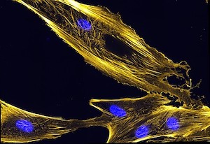 Cytoskeleton | Microtubules, Intermediate & Microfilaments - Lesson ...