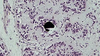 Pineal Gland: Location, Function & Melatonin | Study.com