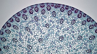 Xylem | Definition & Function - Lesson | Study.com
