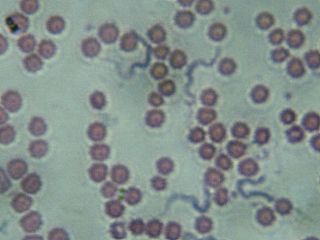 Animal-Like Protists | Movement, Images & Examples - Lesson | Study.com