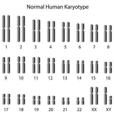 Quiz & Worksheet - Karotyping, Chromosomal Disorders & Epigenetics in ...