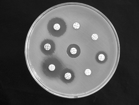 Using Growth Inhibition Procedures to Identify Fungi & Actinomycetes ...