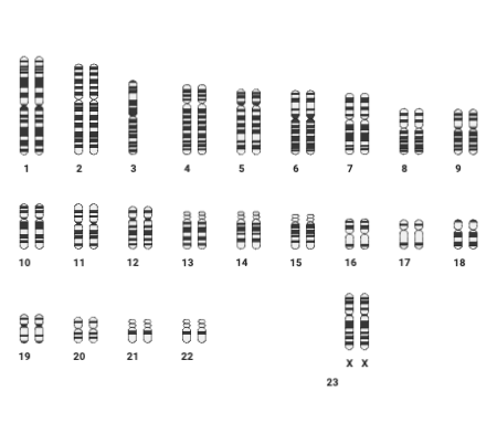 Analyzing a Karyotype to Identify Chromosomal Abnormalities Practice ...