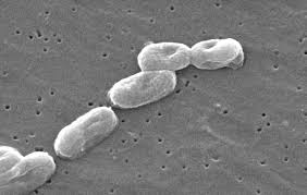 Burkholderia Cepacia: Identification & Characteristics | Study.com