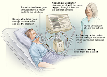 Air-Leak Syndromes: Types, Diagnosis & Treatment | Study.com