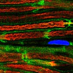 Axon Definition, Types & Function - Lesson | Study.com