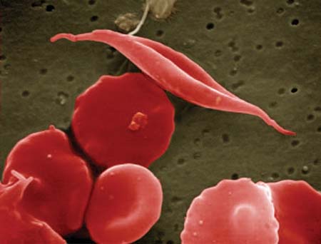 Hematology | Definition, History & Tests | Study.com