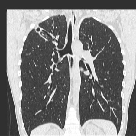 Acid-Fast Bacteria | Overview, Staining & Examples - Lesson | Study.com