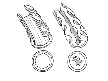 Respiratory Diseases Overview | Obstructive vs. Restrictive - Lesson ...
