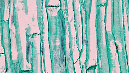 Phloem | Definition, Structure & the Pressure Flow Hypothesis - Lesson ...