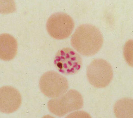 Pathogens | Definition, Types & Examples - Lesson | Study.com