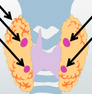 Quiz & Worksheet - Parathyroid Gland | Study.com