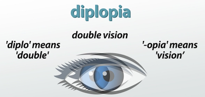 Functional Defects of the Eye: Terminology - Lesson | Study.com