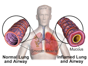Anticholinergics: Definition, Examples & Side Effects - Lesson | Study.com