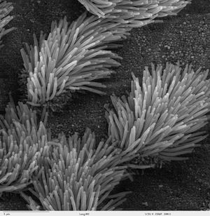 Specific vs. Non-Specific Immunity | Overview & Examples - Lesson ...