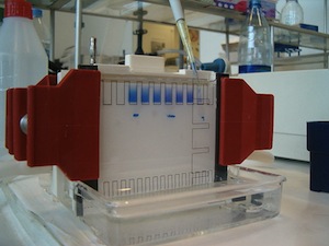 What is Protein Electrophoresis? | Study.com