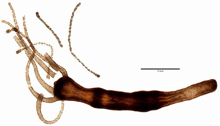 Types of Digestion | Intracellular & Extracellular - Video & Lesson ...