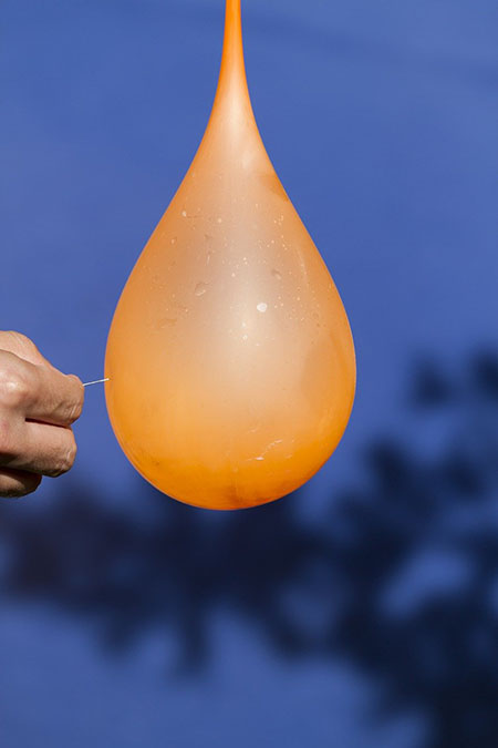 Ureters, Bladder & Urethra | Structures, Function & Medical Terms ...