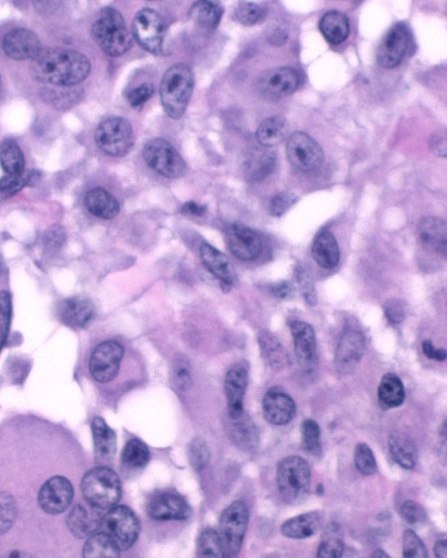 Amitosis in Plants: Definition & Process | Study.com