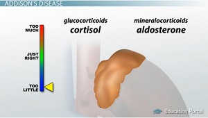 Adrenal Gland Disorders & Treatments: Addison's Disease and Prednisone ...