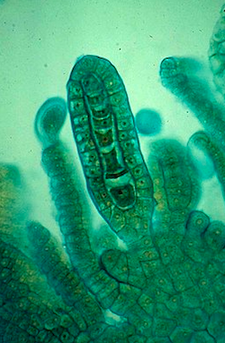 Archegonium & Antheridium | Definition, Structure & Function - Lesson ...