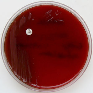 Gram-Negative Anaerobes: Characteristics, Types & Examples | Study.com