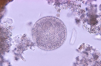 What is Balantidiasis? - Symptoms & Treatment | Study.com