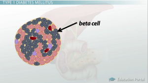 Disorders of the Pancreas: Types, Symptoms & Treatments - Lesson ...