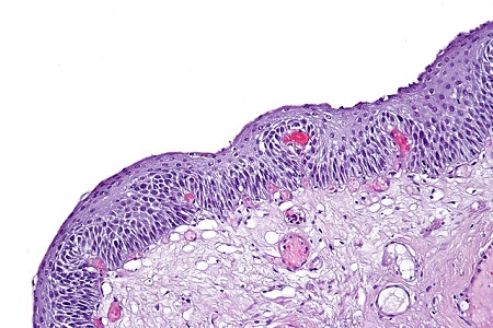 Epithelial Tissue | Function, Structure & Types - Lesson | Study.com