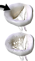 Aortic Semilunar Valve | Location, Structure & Function - Lesson ...