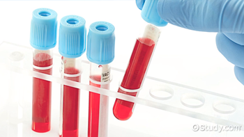 Composition of Blood | Components, Function & Percentage - Lesson ...
