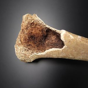 Calcium Ion Charge, Formula & Importance - Lesson | Study.com