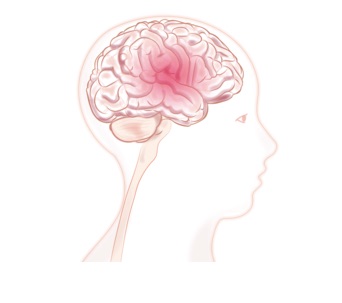 Clonus | Definition, Causes & Treatment - Lesson | Study.com