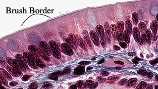 Villi in the Small Intestine | Definition, Function & Structure ...