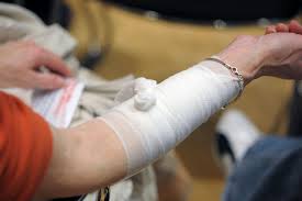 Chemical Burns: Treatment & First Aid | Study.com