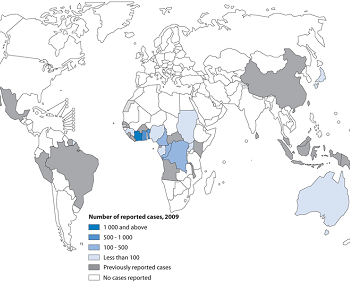 Buruli Ulcer Disease: Causes, Symptoms & Treatment | Study.com