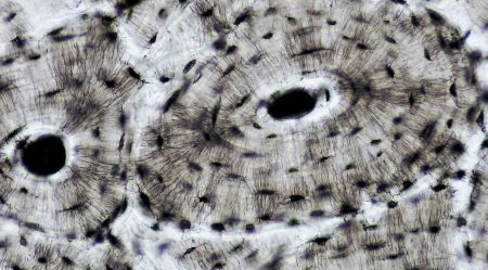 Identify these structures. a. canaliculi b. central canal c. lacuna d ...
