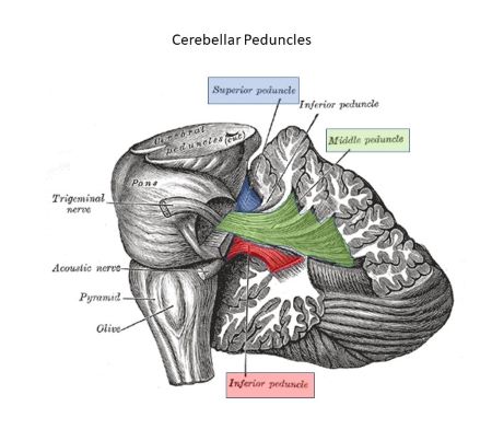 In what region of the brainstem are the cerebellar peduncles located? a ...