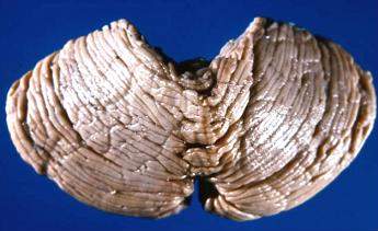 Cerebellum Lesson for Kids | Study.com