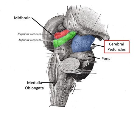 In what region of the brainstem are the cerebral peduncles located? a ...