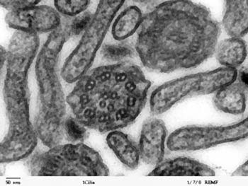 Cilia in Cells | Characteristics, Structure & Function - Lesson | Study.com