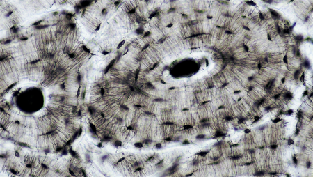 Anatomy of the Bone | Parts, Types & Categories - Lesson | Study.com