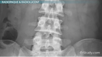 Vocabulary for Contrast Medium in Medical Imaging - Lesson | Study.com
